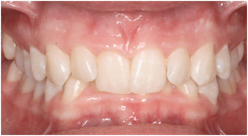 Common Problems - Sebastopol Orthodontics